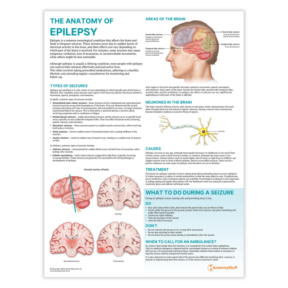 The Anatomy of Epilepsy Chart / Poster - | AnatomyStuff