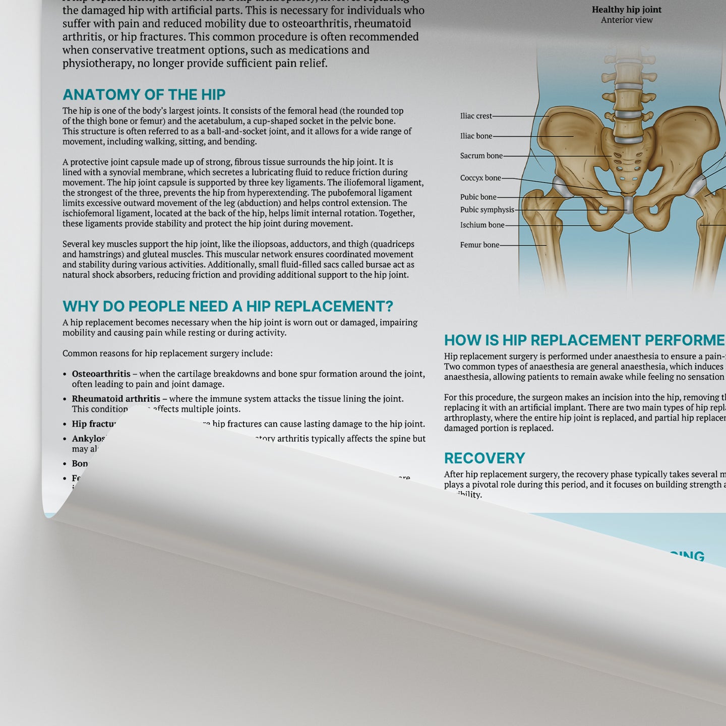 The Anatomy of Hip Replacement | Knee Replacement Chart – AnatomyStuff