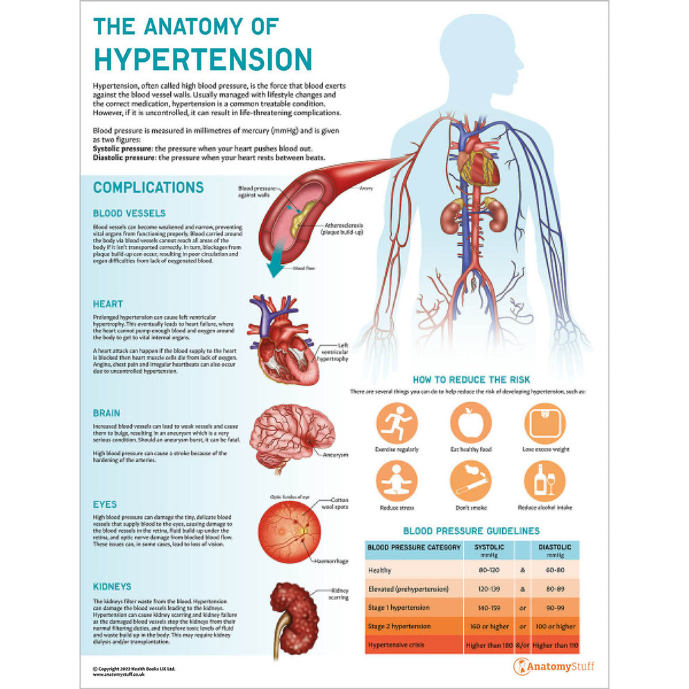 Hypertension Collection | Health Education Charts & Models Set ...