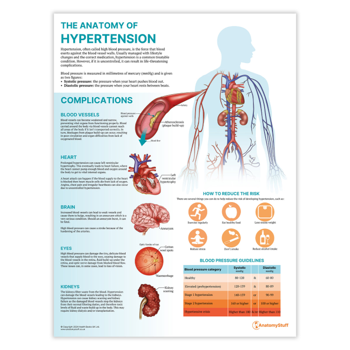 Anatomy of Hypertension Chart | Understanding Hypertension – AnatomyStuff
