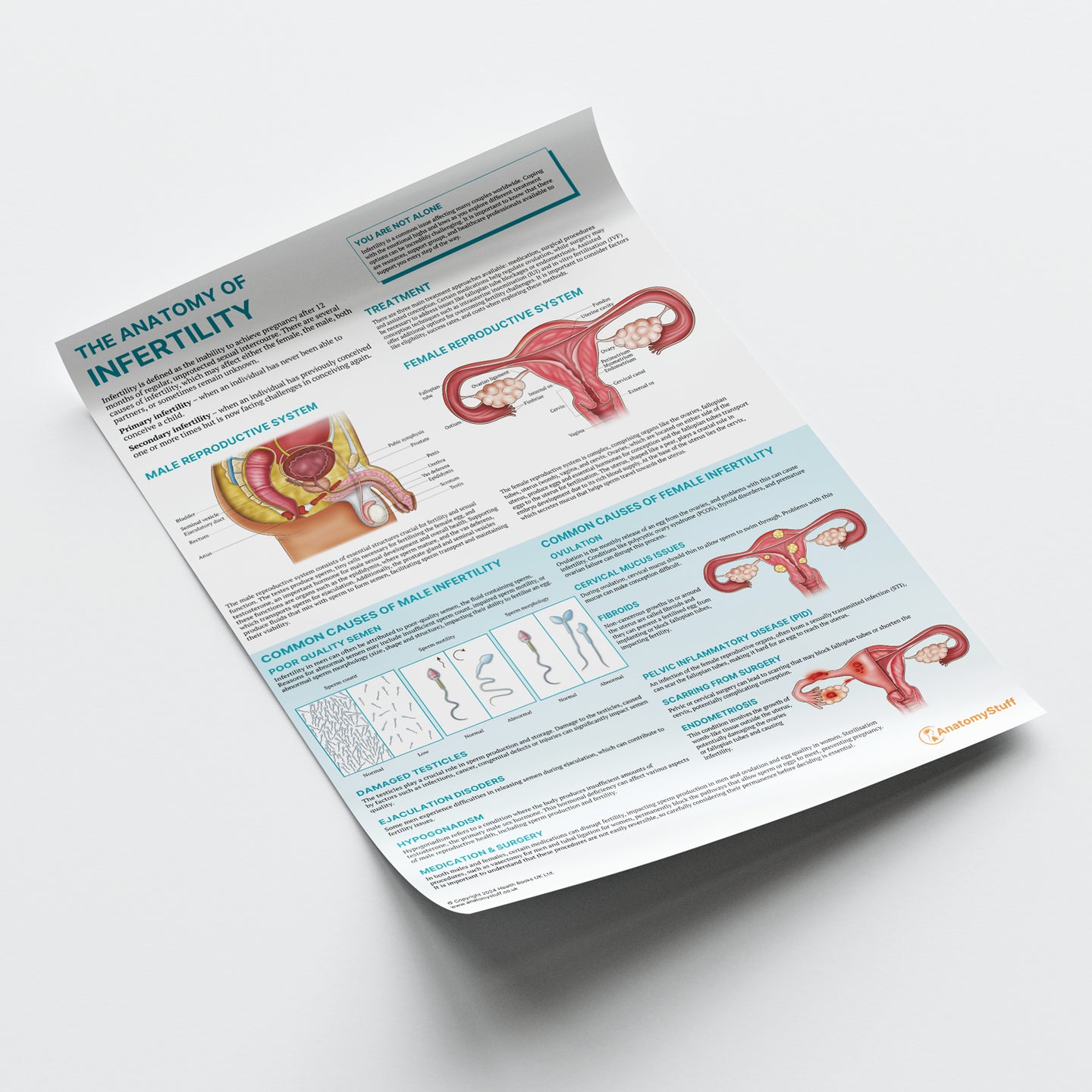 The Anatomy of Infertility Chart / Poster - | AnatomyStuff