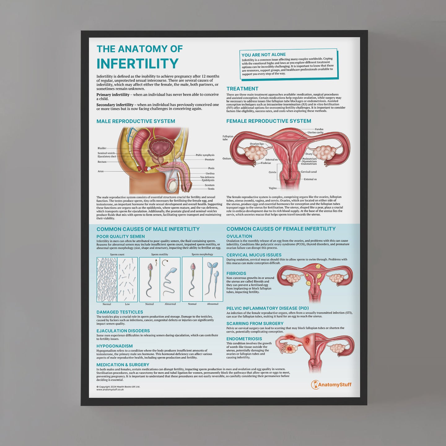 The Anatomy of Infertility Chart / Poster - | AnatomyStuff