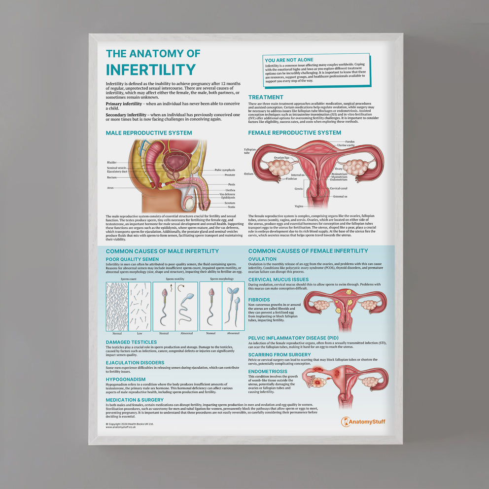 The Anatomy of Infertility Chart / Poster - | AnatomyStuff