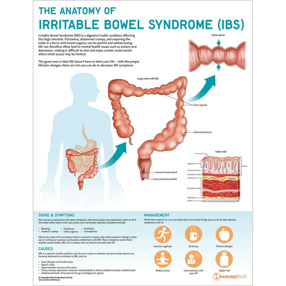 Irritable Bowel Syndrome Collection | IBS Charts & Models Set ...