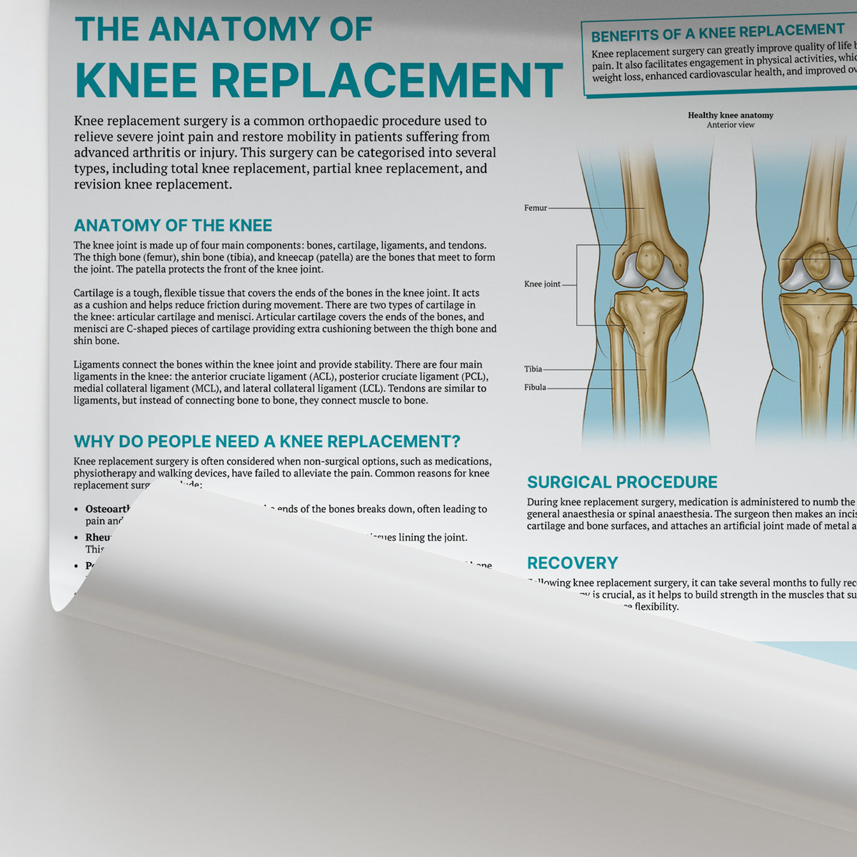The Anatomy of the Knee | Knee Replacement Chart – AnatomyStuff