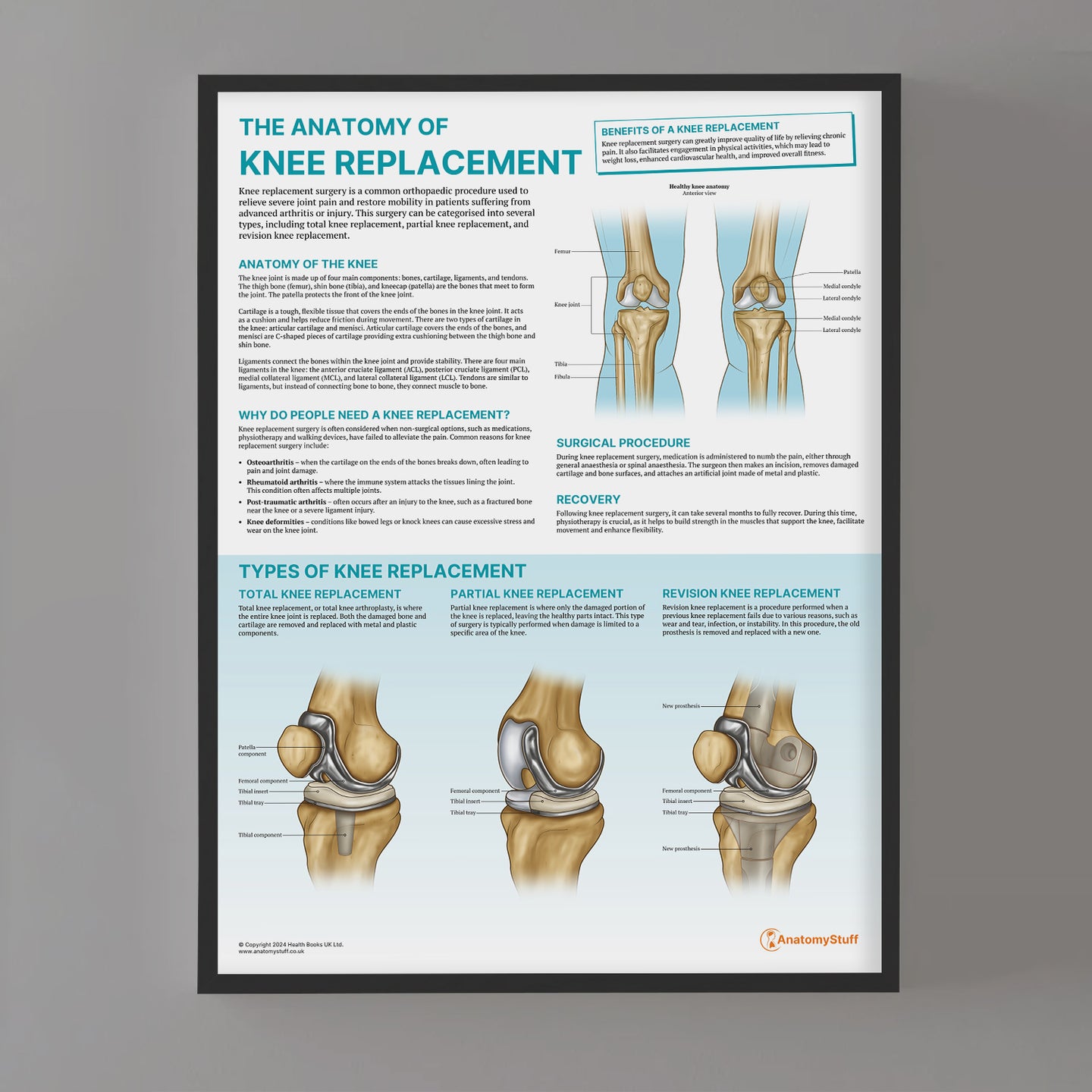 The Anatomy of the Knee | Knee Replacement Chart – AnatomyStuff