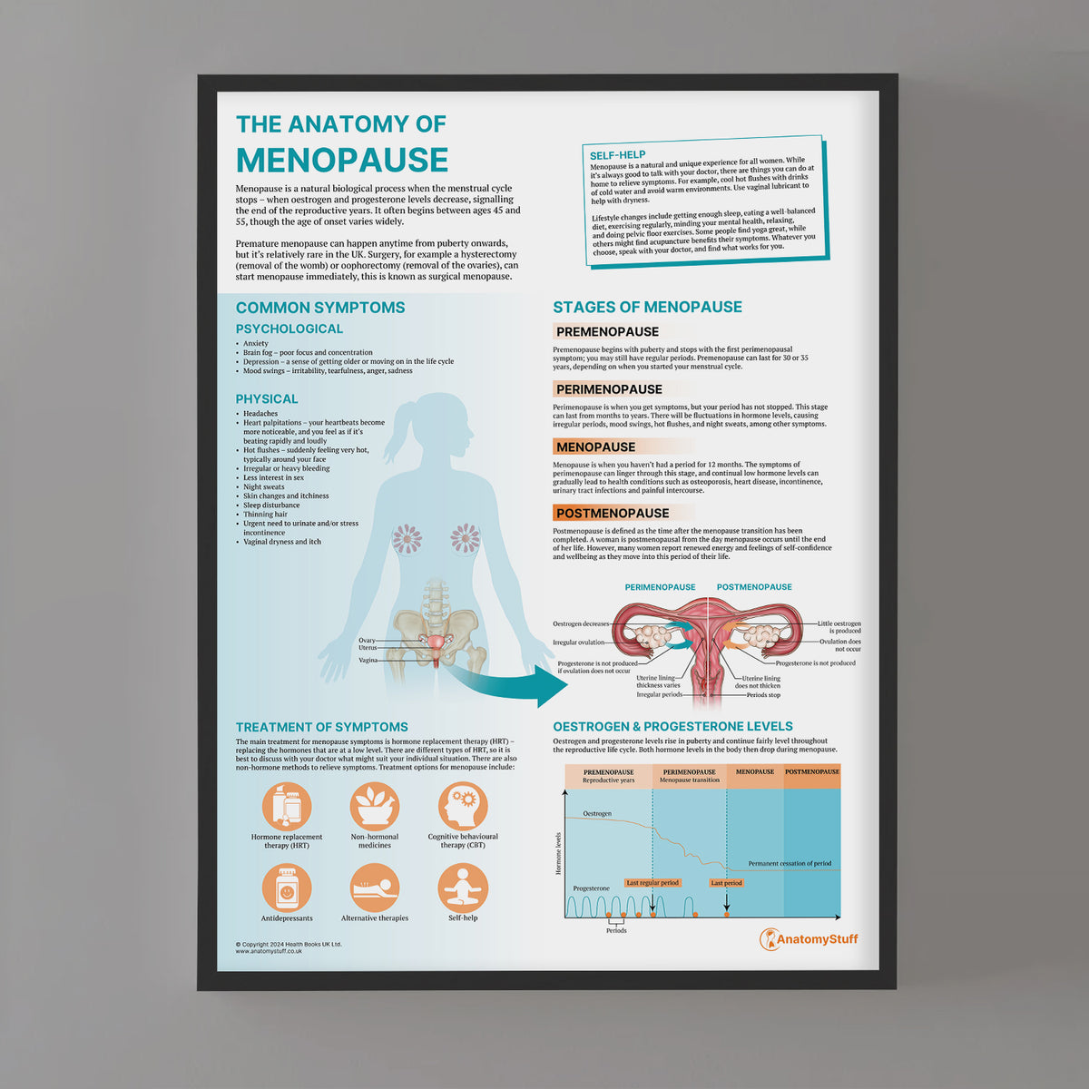 The Anatomy of Menopause Poster | Women‚Äôs Health | AnatomyStuff
