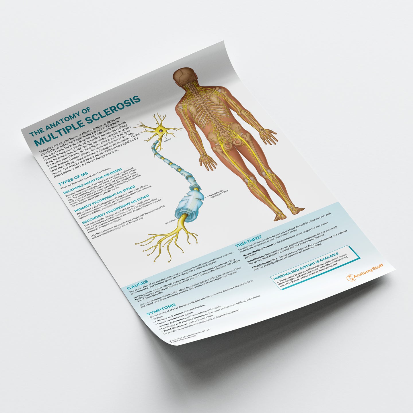 The Anatomy of Multiple Sclerosis Chart / Poster - | AnatomyStuff
