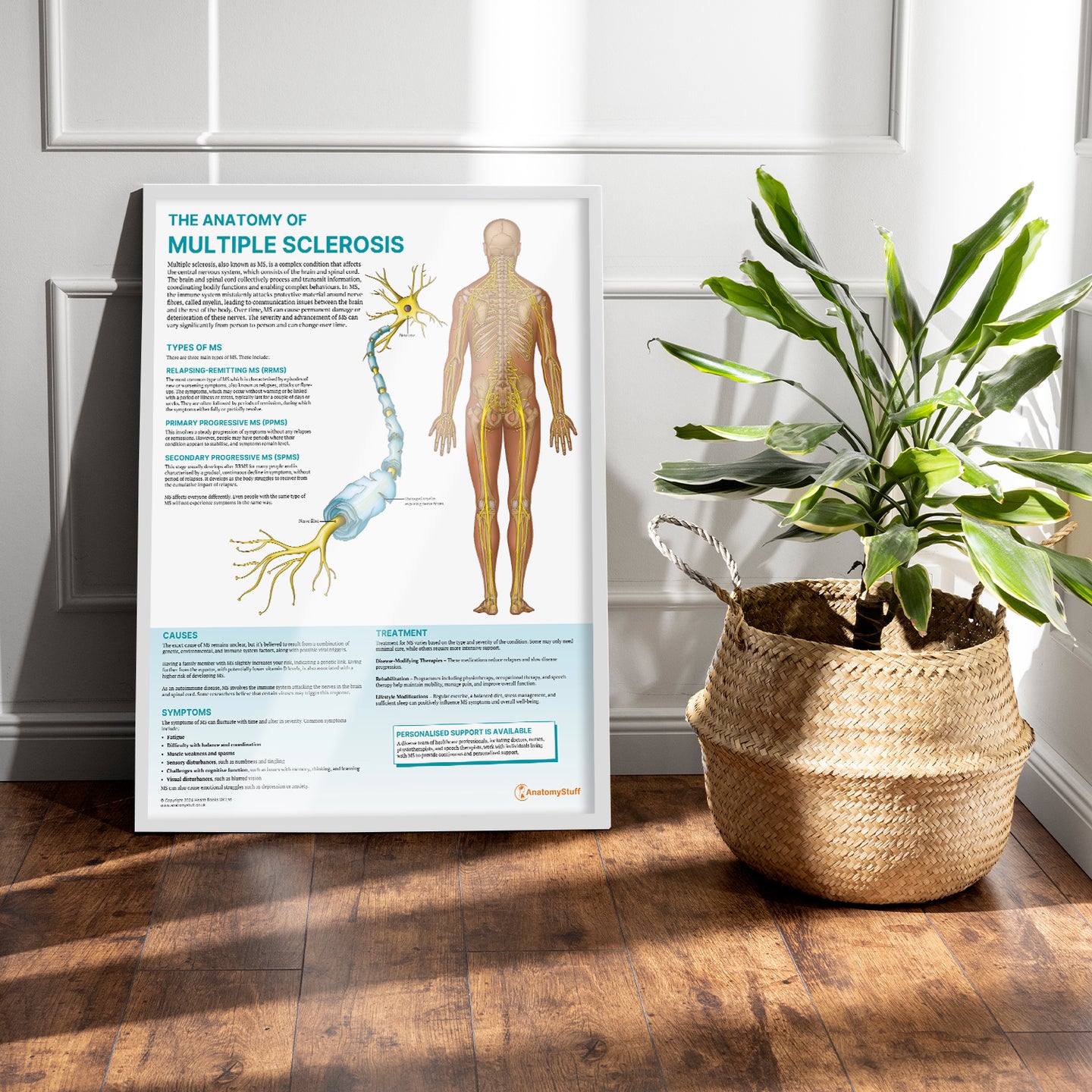 The Anatomy of Multiple Sclerosis Chart / Poster - | AnatomyStuff