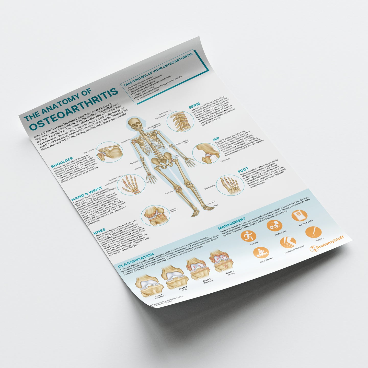 The Anatomy of Osteoarthritis | OA Chart | Anatomy Stuff – AnatomyStuff