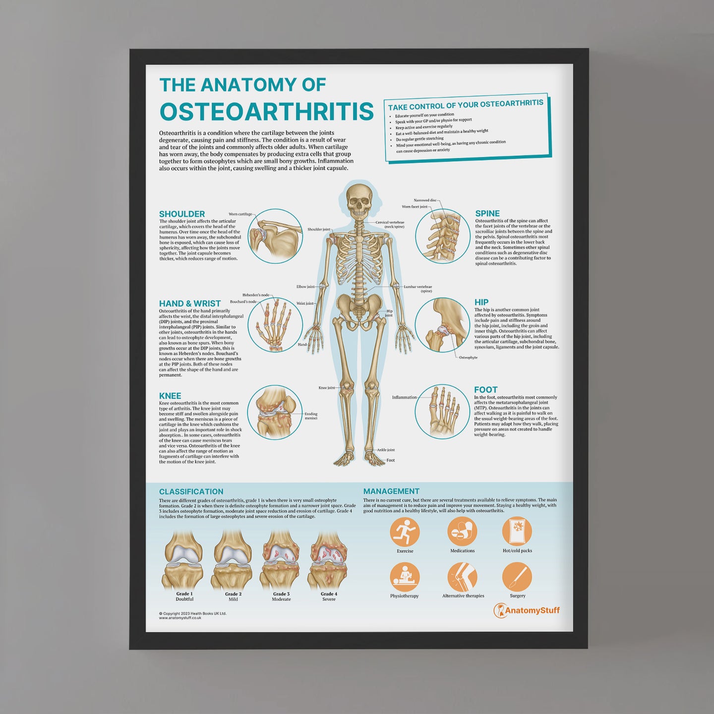 The Anatomy of Osteoarthritis | OA Chart | Anatomy Stuff – AnatomyStuff