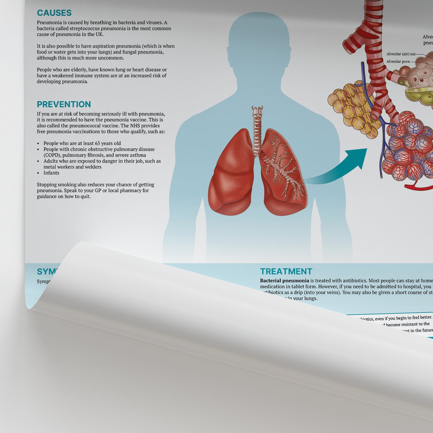 The Anatomy of Pneumonia Chart/Poster ‚Äì Laminated | Respiratory ...
