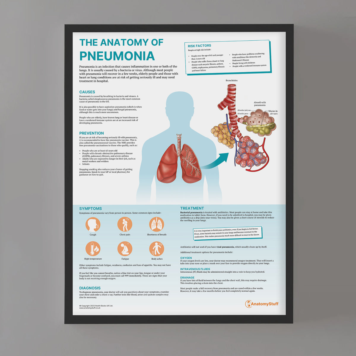 The Anatomy of Pneumonia Chart/Poster ‚Äì Laminated | Respiratory ...