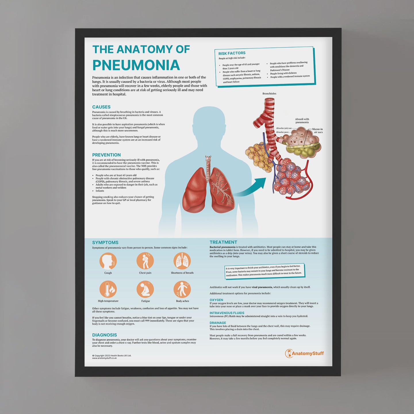 The Anatomy of Pneumonia Chart/Poster ‚Äì Laminated | Respiratory ...