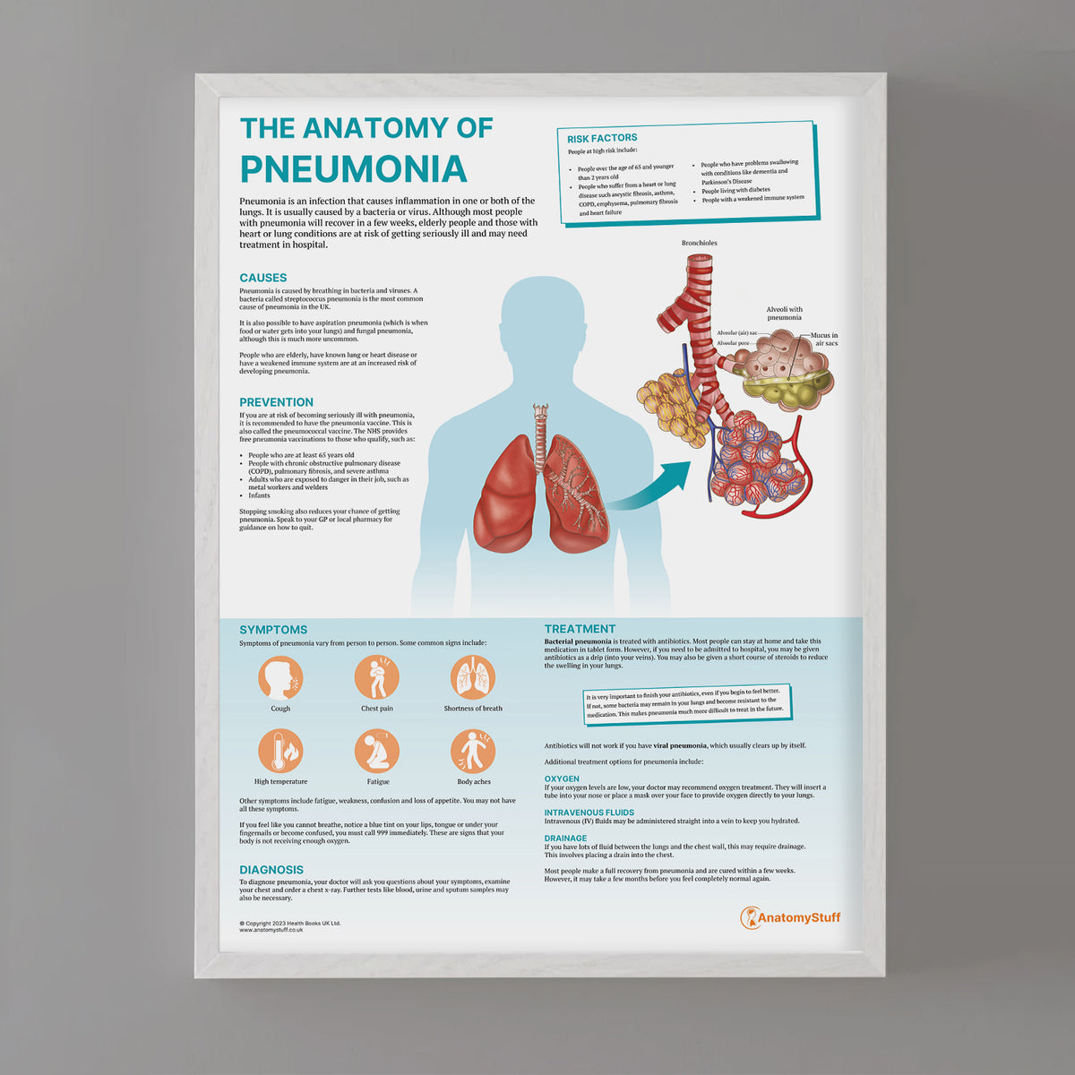 The Anatomy of Pneumonia Chart/Poster ‚Äì Laminated | Respiratory ...