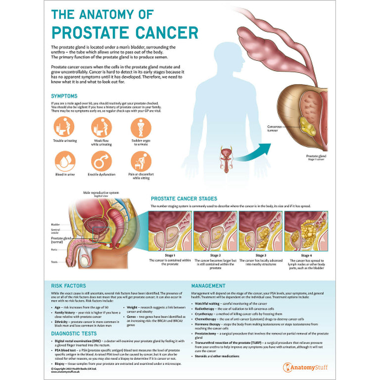 Prostate Anatomy & Pathology Collection | Urology Models | AnatomyStuff