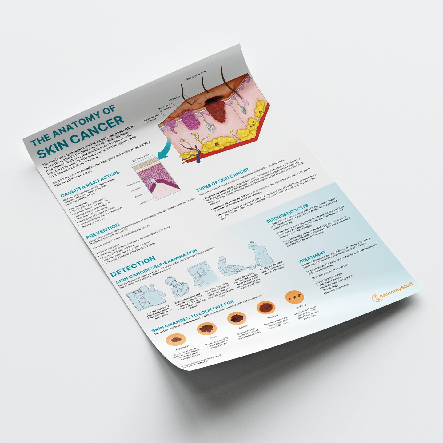 The Anatomy of Skin Cancer Chart / Poster ‚Äì Laminated | AnatomyStuff