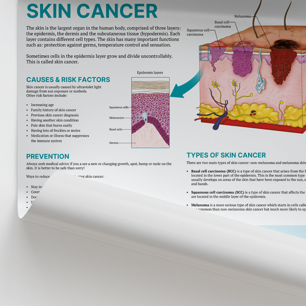 The Anatomy of Skin Cancer Chart / Poster ‚Äì Laminated | AnatomyStuff