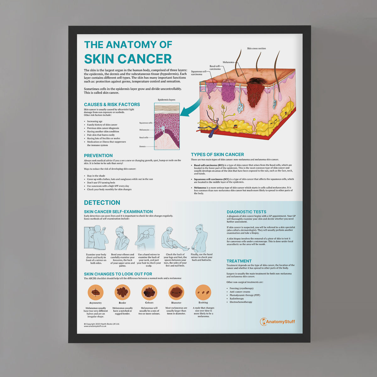 The Anatomy of Skin Cancer Chart / Poster ‚Äì Laminated | AnatomyStuff