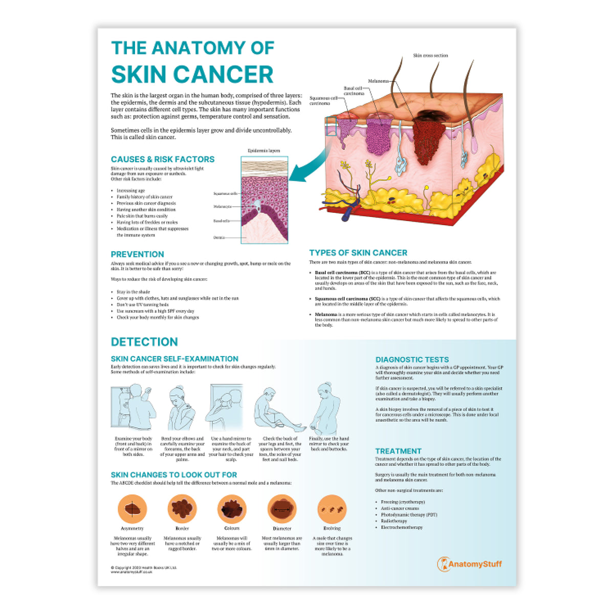 The Anatomy of Skin Cancer Chart / Poster ‚Äì Laminated | AnatomyStuff