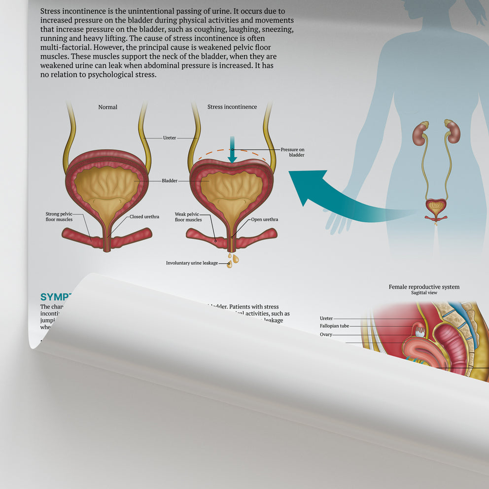 The Anatomy of Stress Incontinence | Urology Chart | Anatomy Stuff ...