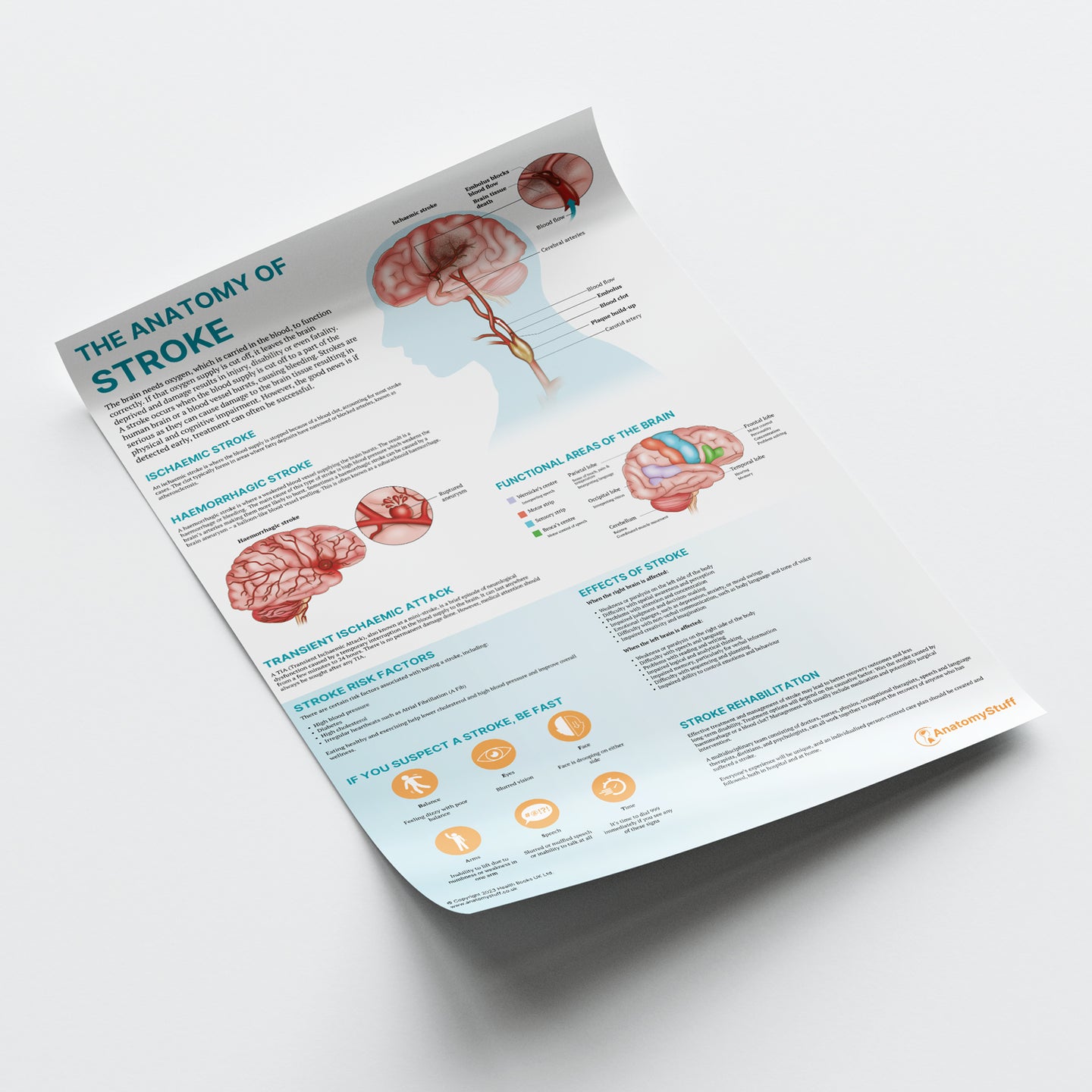 The Anatomy of Stroke | Neuro Pathology Education | AnatomyStuff