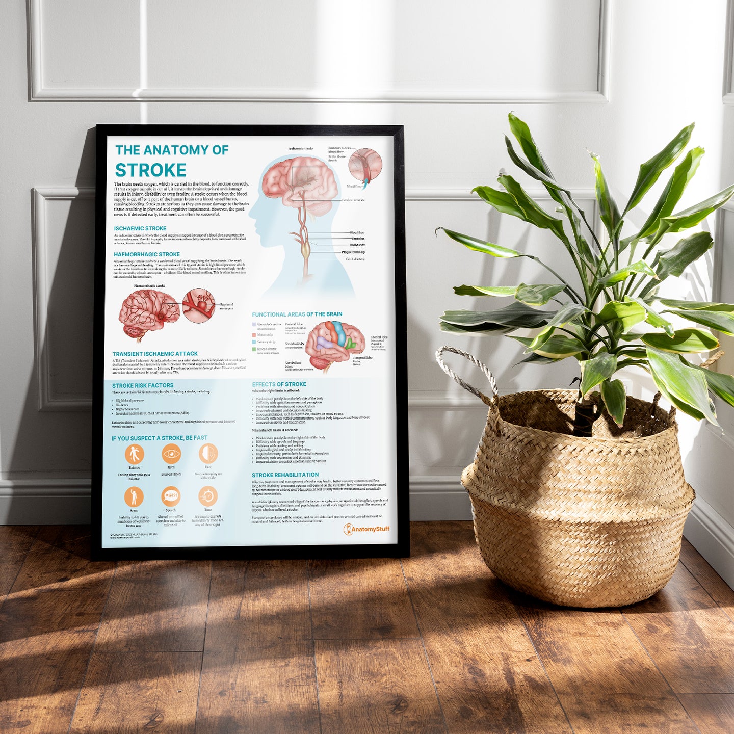 The Anatomy of Stroke | Neuro Pathology Education | AnatomyStuff