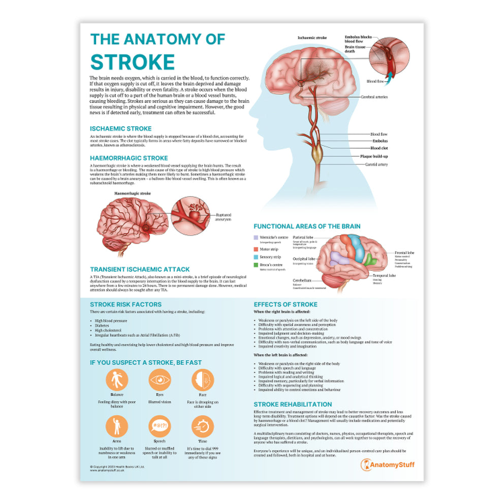 The Anatomy of Stroke | Neuro Pathology Education | AnatomyStuff