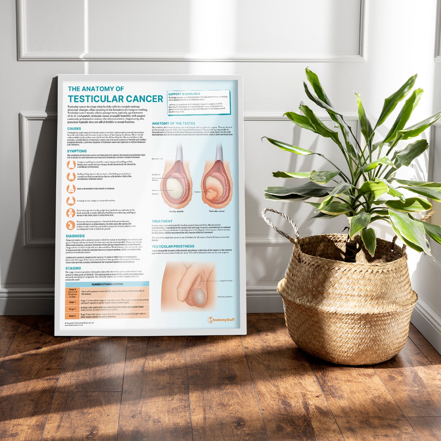 The Anatomy of Testicular Cancer Chart / Poster - | AnatomyStuff