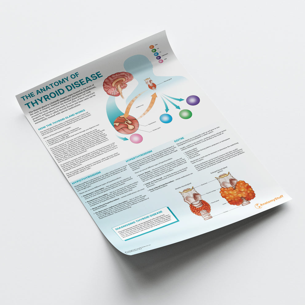 The Anatomy of Thyroid Disease Chart/Poster Laminated | Endocrine ...