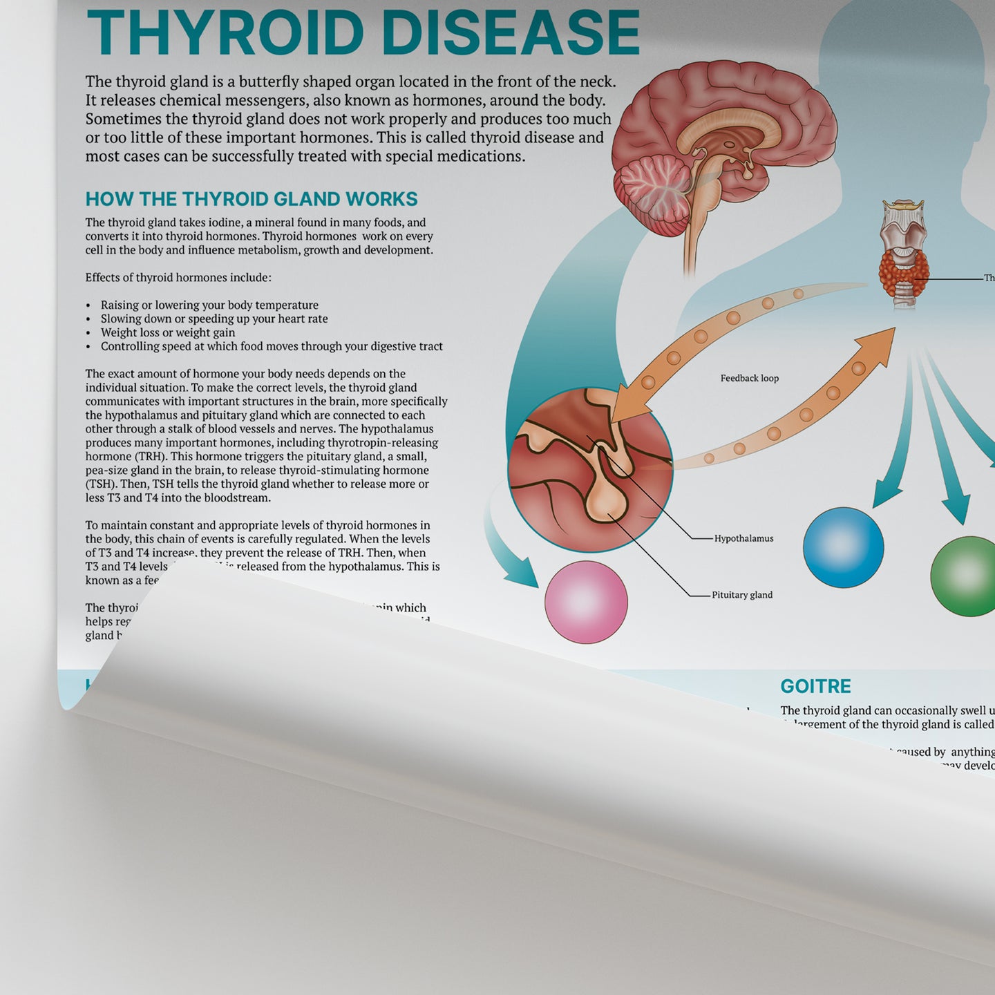 The Anatomy of Thyroid Disease Chart/Poster Laminated | Endocrine ...