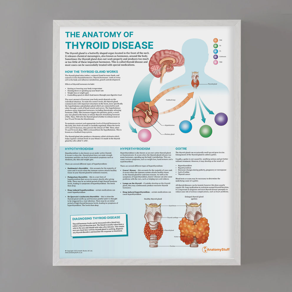 The Anatomy of Thyroid Disease Chart/Poster Laminated | Endocrine ...