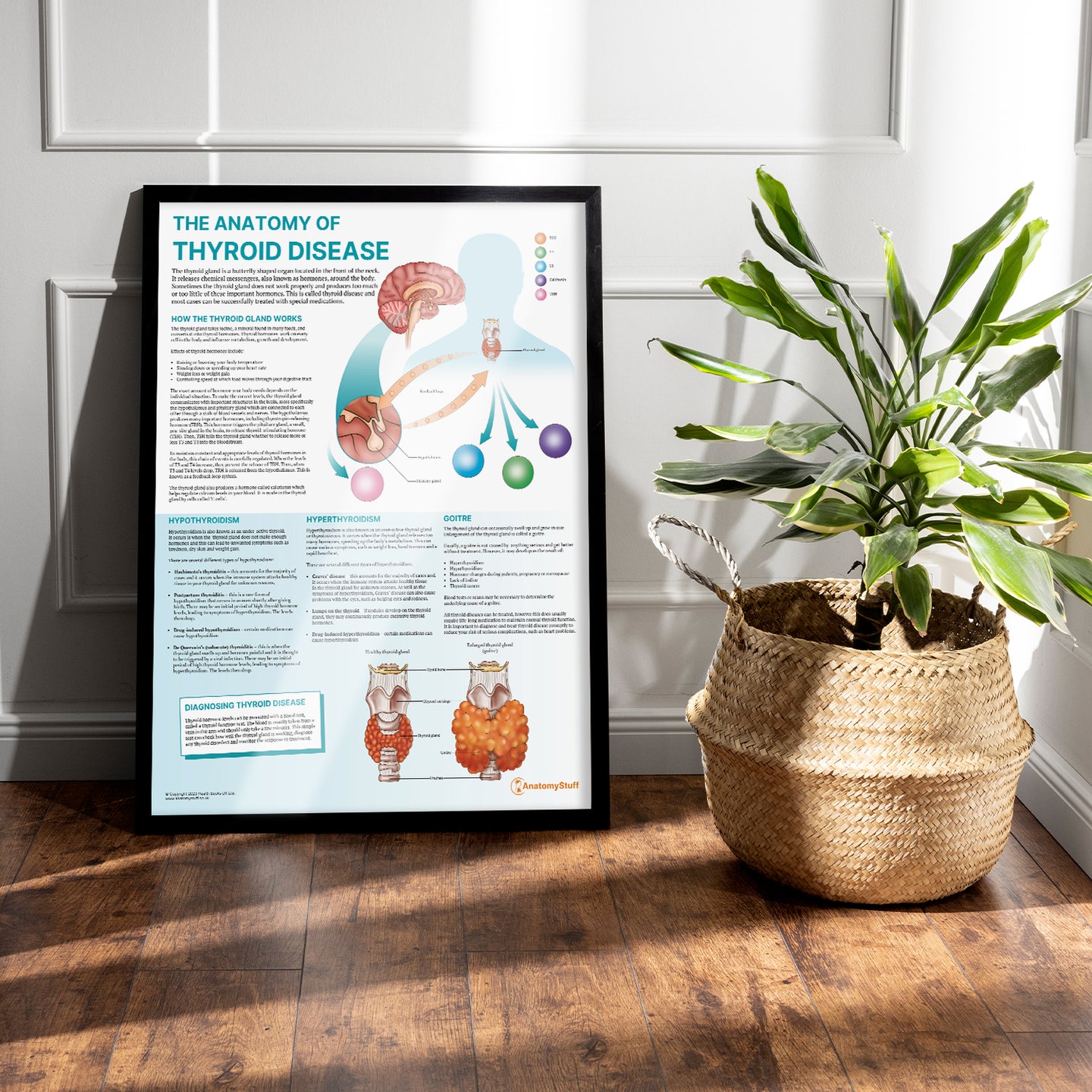 The Anatomy of Thyroid Disease Chart/Poster Laminated | Endocrine ...
