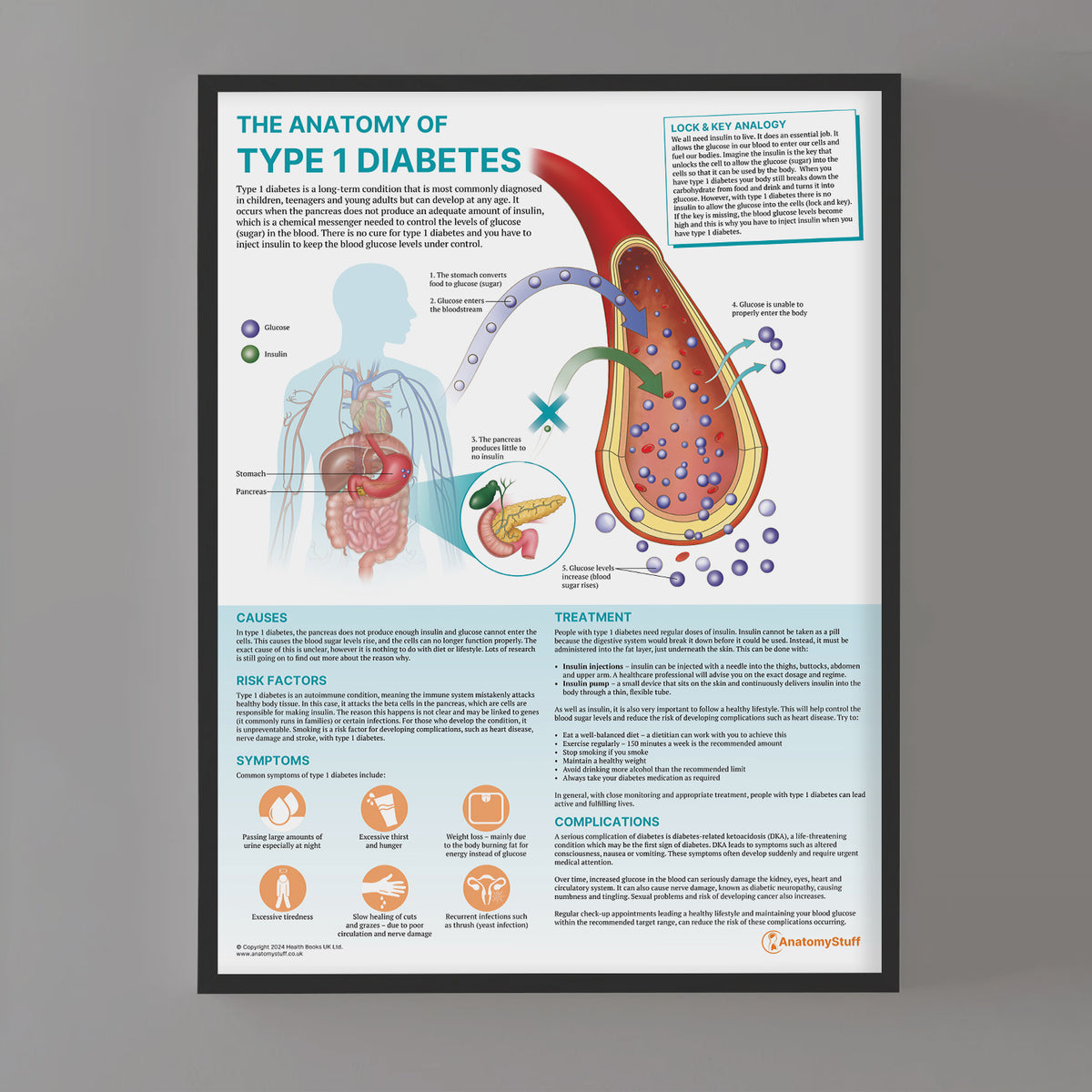 The Anatomy of Type 1 Diabetes Chart/Poster Laminated | Endocrine ...