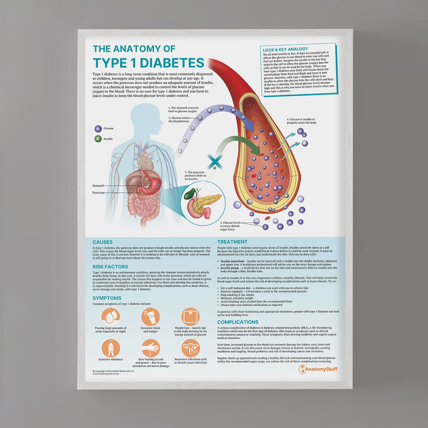 The Anatomy of Type 1 Diabetes Chart/Poster Laminated | Endocrine ...