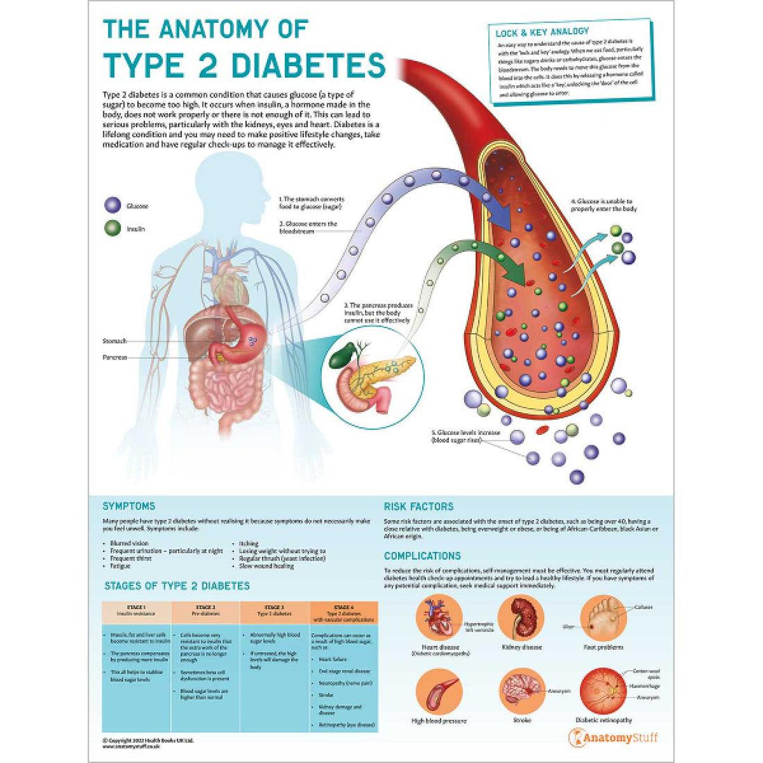 Type II Diabetes Education Collection | Glucose Insulin Models Charts ...
