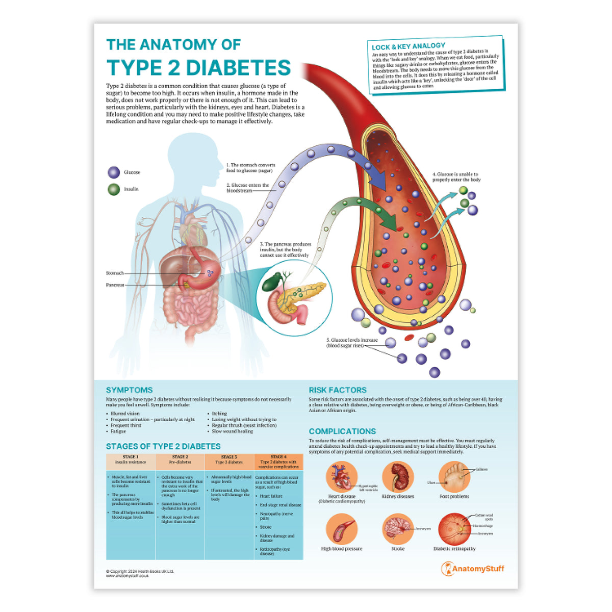 Anatomy of Type 2 Diabetes Chart | Understanding Type 2 Diabetes ...