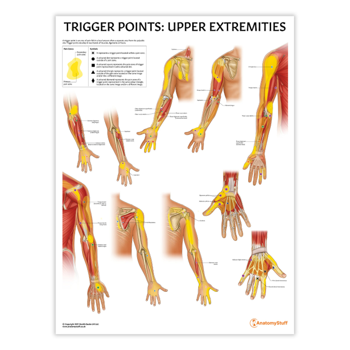 Trigger Points: Upper Extremities | Myofascial Pain Charts – AnatomyStuff