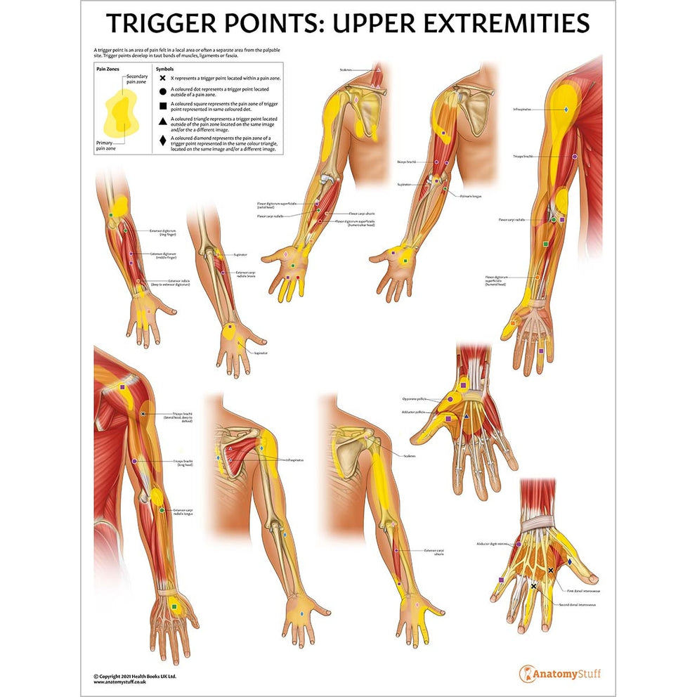 Trigger Points 3 Poster Collection | Myofascial Pain Charts – AnatomyStuff
