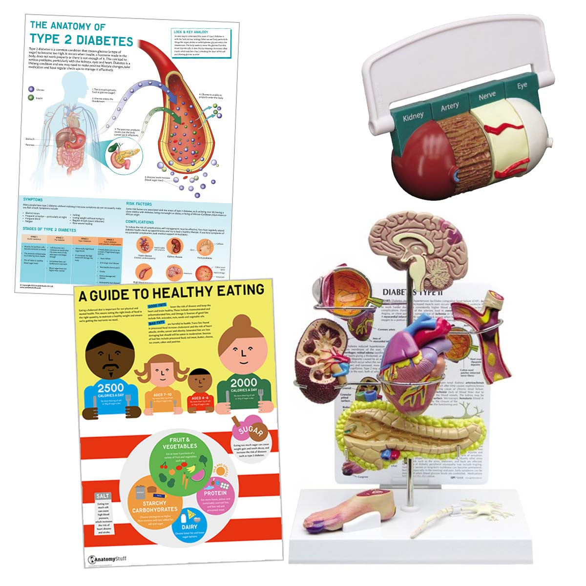 Type II Diabetes Education Collection | Glucose Insulin Models Charts ...