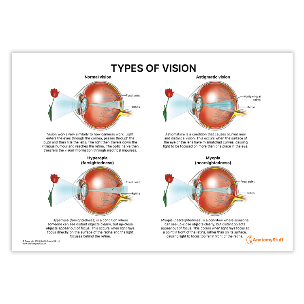 Types of Vision PDF | Eye Poster Anatomical | AnatomyStuff