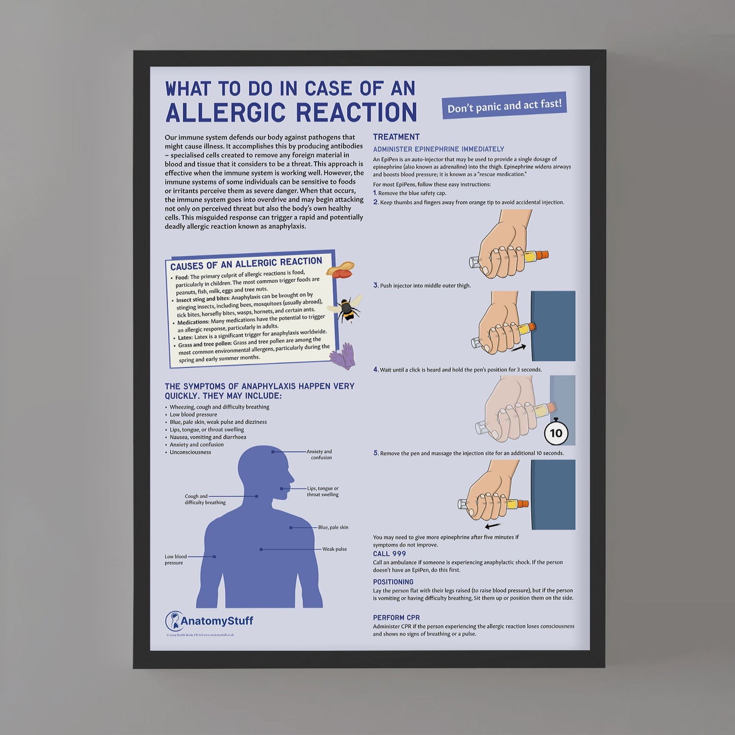 What To Do In Case of An Allergic Reaction Poster | AnatomyStuff