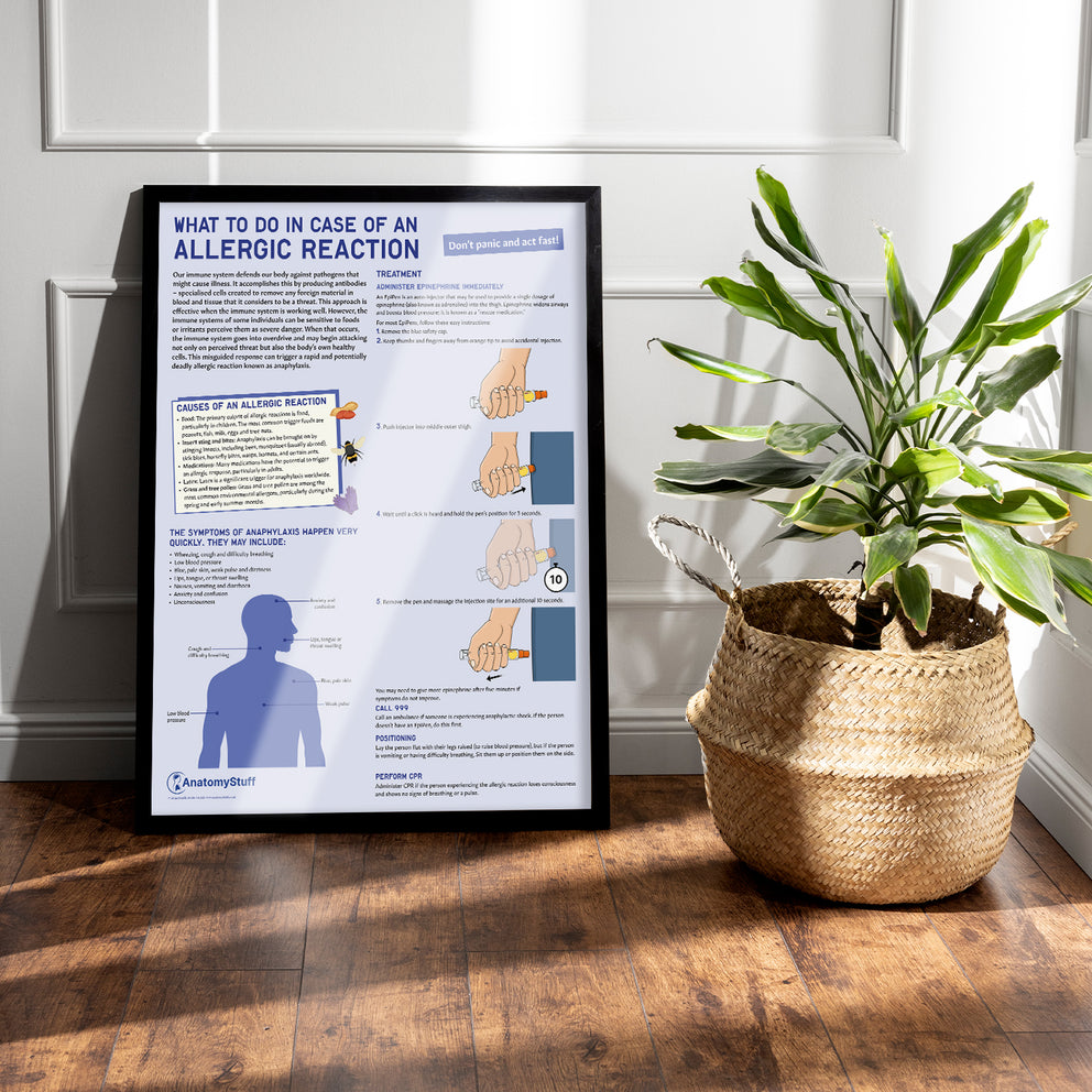 What To Do In Case of An Allergic Reaction Poster | AnatomyStuff